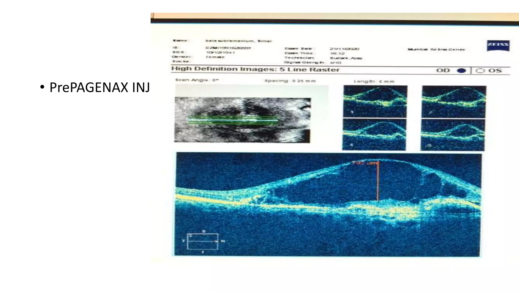 Cases with PAGENAX -DR AJAY DUDANI | PPTX