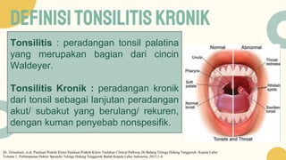 Case Tonsilitis -Ariel.pptx
