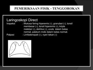 Case Tubair Catarrh | PPTX