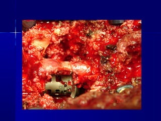 Case zouridakis | PPT | Death, Injury, or Military Conflict | Sensitive ...