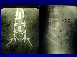 Case zouridakis | PPT | Death, Injury, or Military Conflict | Sensitive ...