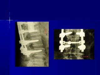 Case zouridakis | PPT | Death, Injury, or Military Conflict | Sensitive ...