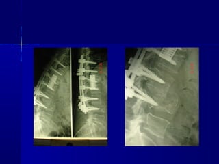 Case zouridakis | PPT | Death, Injury, or Military Conflict | Sensitive ...