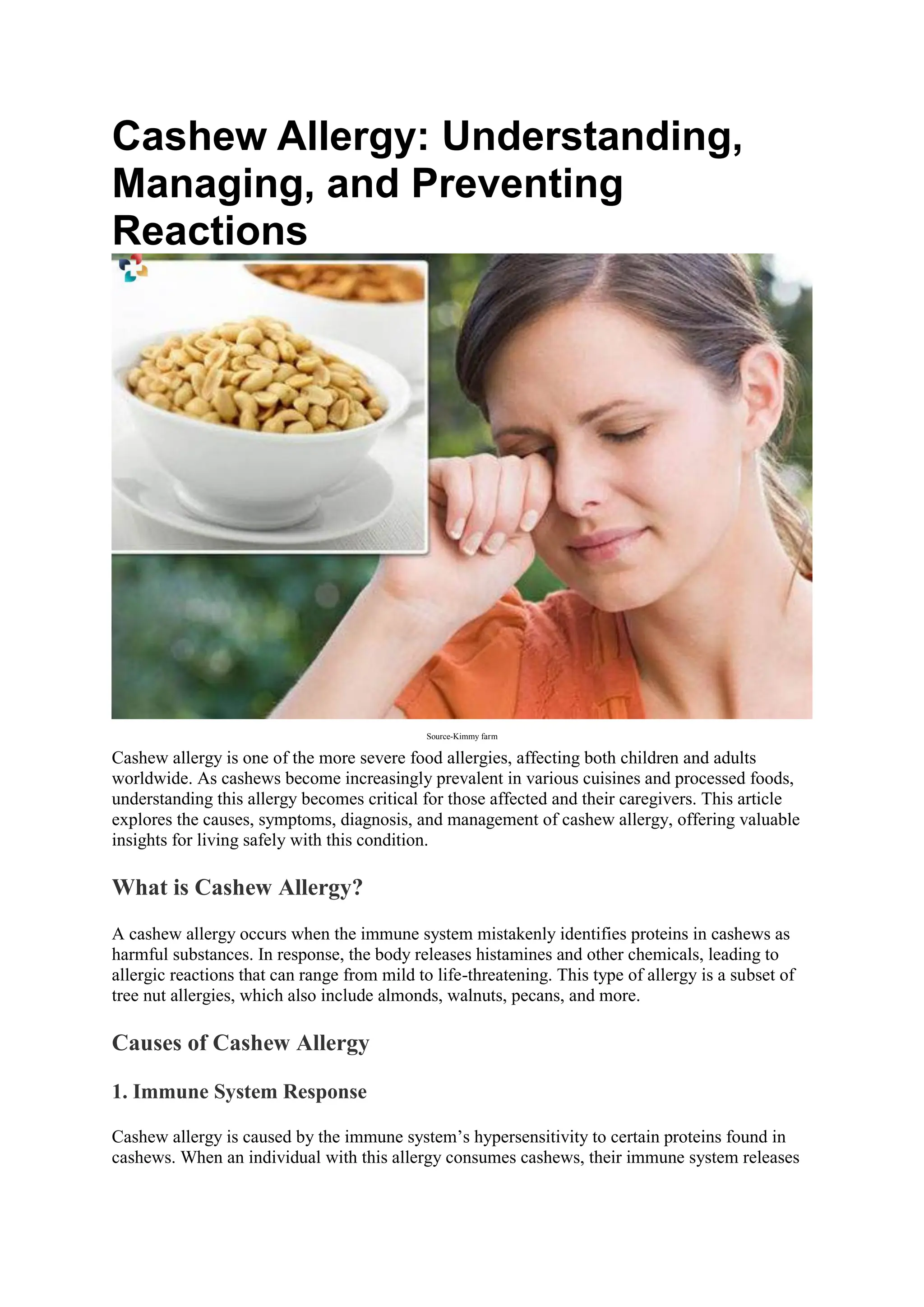Cashew Allergy: Causes, Symptoms, Preventions, and Diagnosing | The ...
