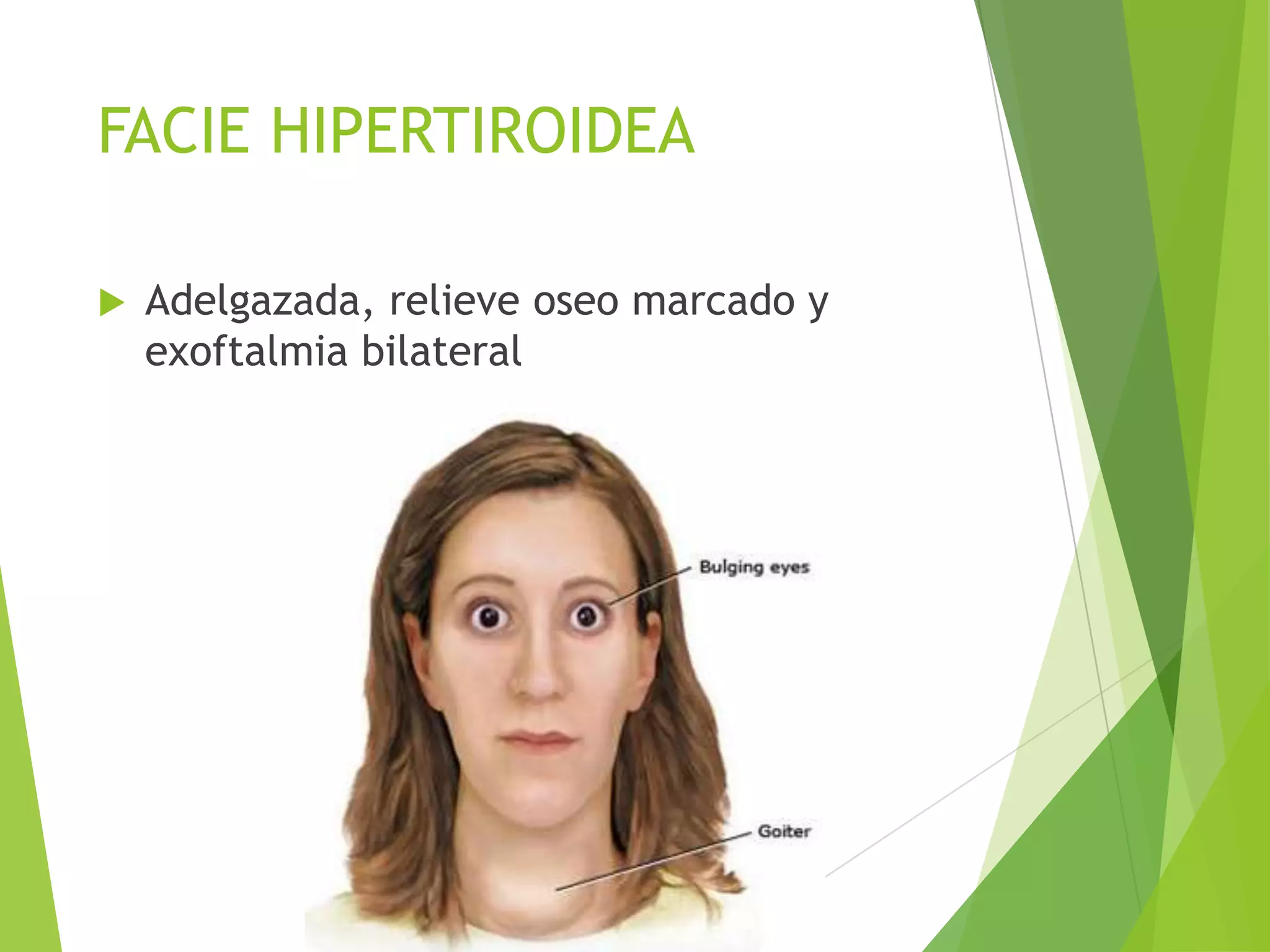 Semiologia Médica - Facies | PPTX