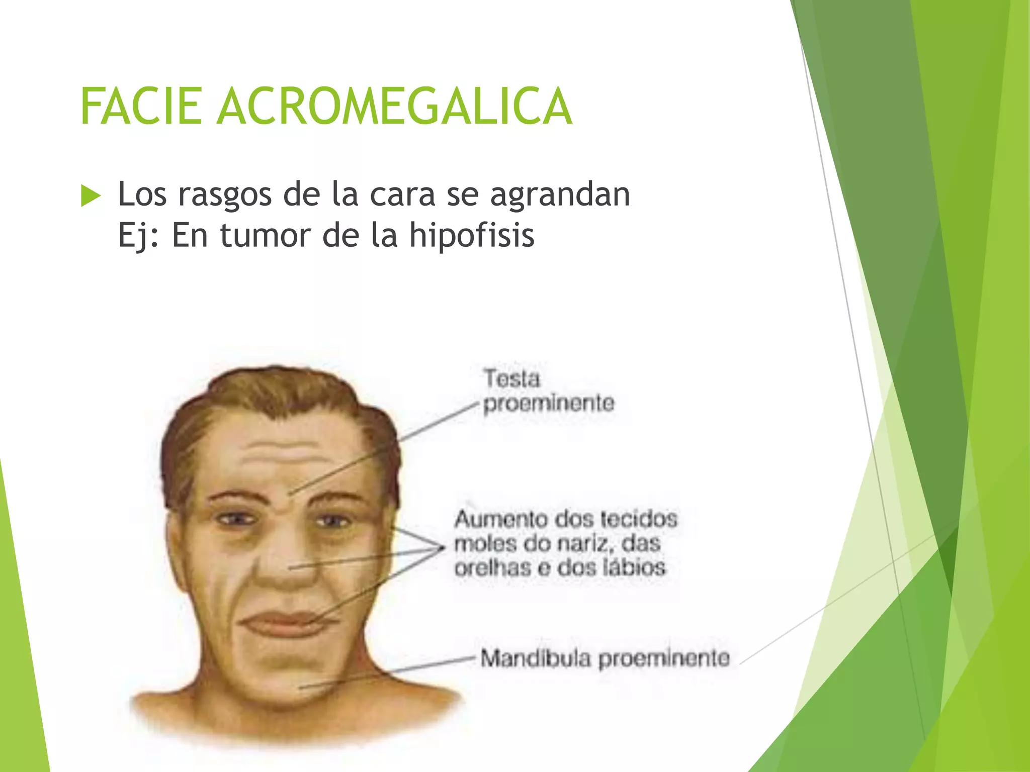 Semiologia Médica - Facies | PPTX