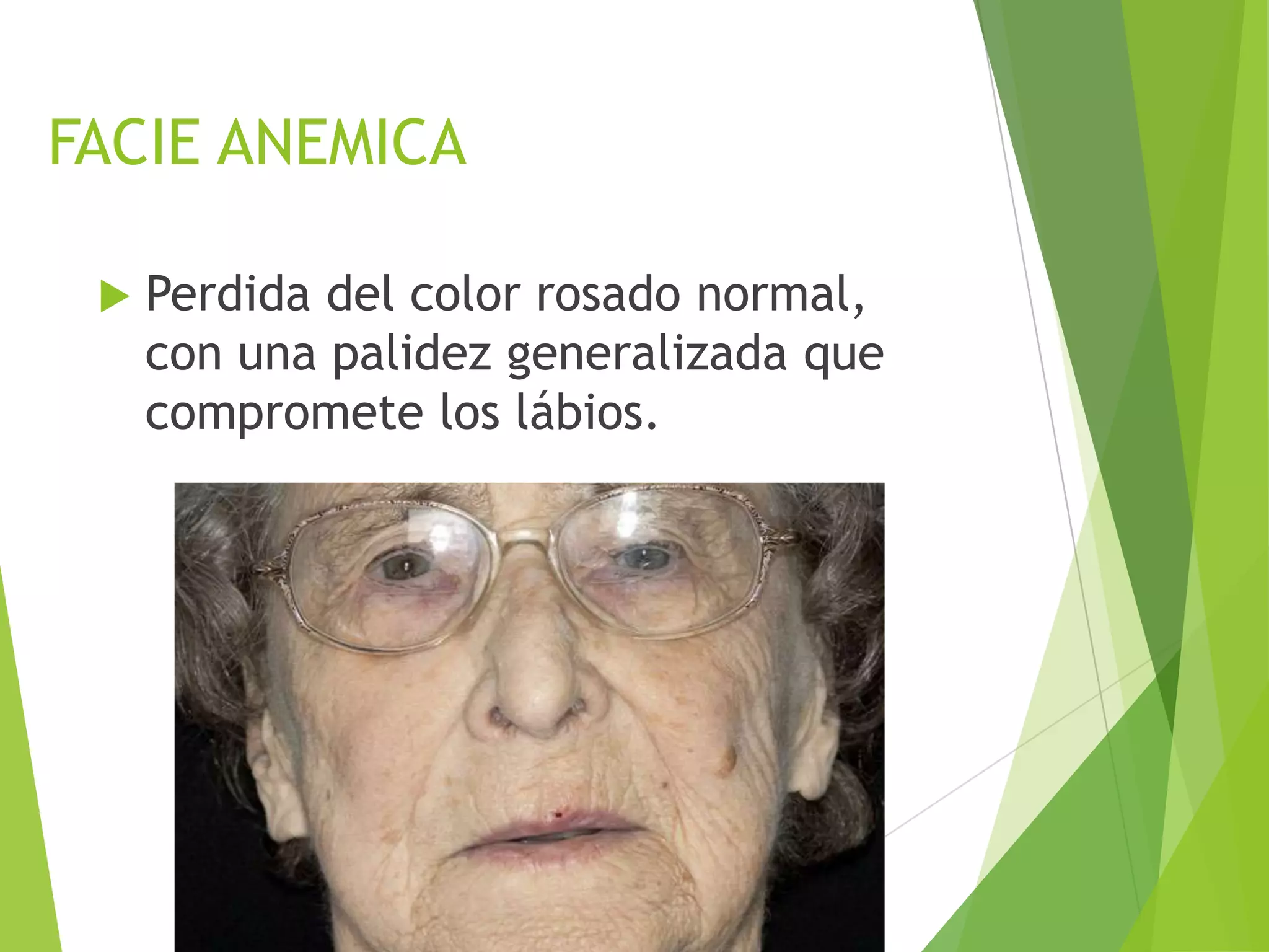 Semiologia Médica - Facies | PPTX