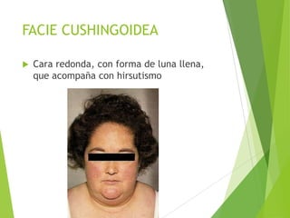 Semiologia Médica - Facies | PPTX