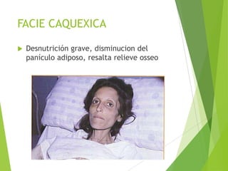 Semiologia Médica - Facies | PPTX