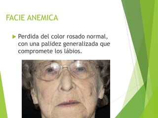Semiologia Médica - Facies | PPTX