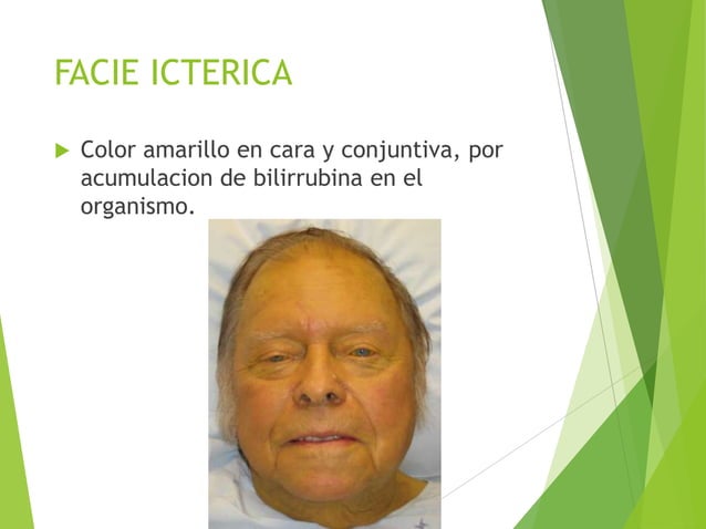 Semiologia Médica - Facies | PPTX