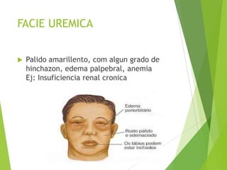 Semiologia Médica - Facies | PPTX
