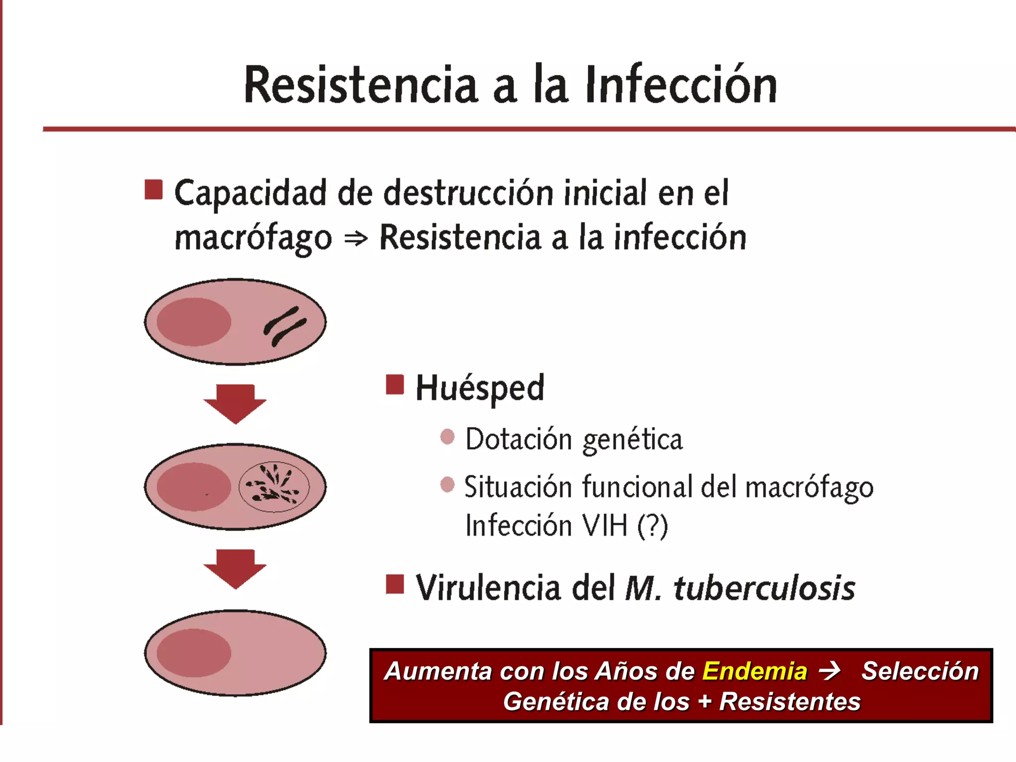 Caso Interesante tuberculosis pulmonar (bulas) | PPTX