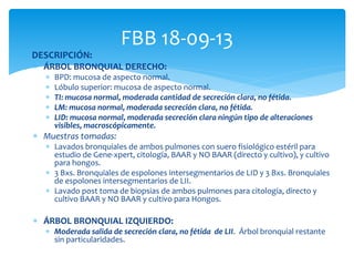 Caso Interesante tuberculosis pulmonar (bulas) | PPTX