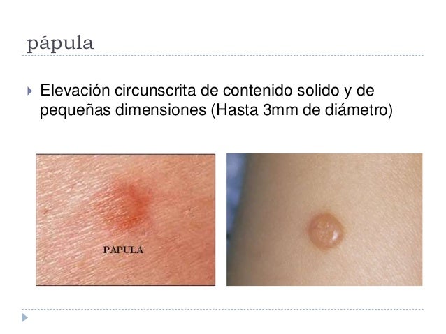 Caso 12 lesiones en cavidad oral