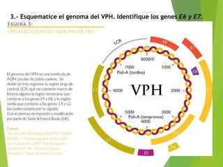 Caso 26 vph | PPTX