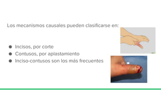 Caso clinico .pptx