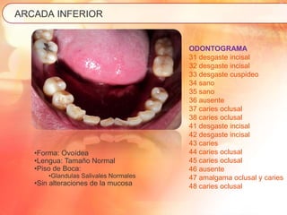 Caso clinico operatoria dental | PPTX