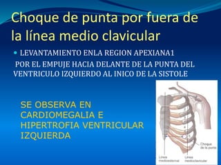 HIPERTENSION ARTERIAL. CASO CLINICO 2 | PPTX