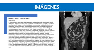 restitución ilesotomia en paciente por neoplasia | PPTX