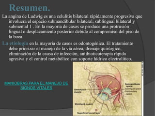 Caso clinico angina de ludwig | PPTX