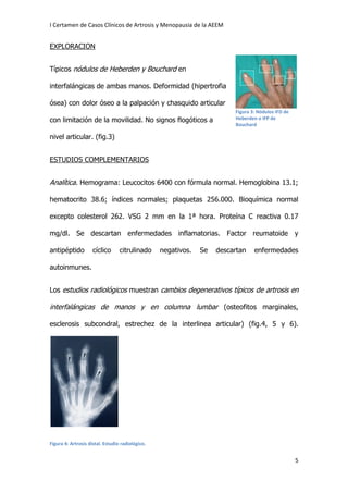 Caso clinico artrosis menopausica | PDF