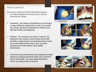 CASO_CLINICO_CIRUGIA_FRENILLO.pptx