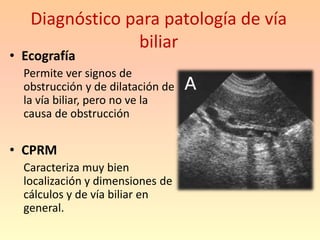 Diagnóstico de coledocolitiasis en RM | PPTX