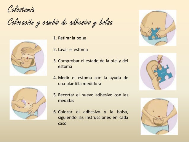 Caso clinico completo