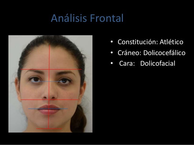 Caso clinico daniela montalvo