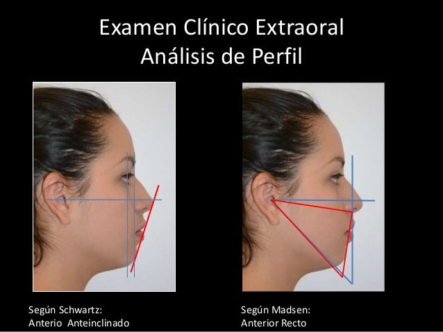 Caso clinico daniela montalvo