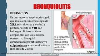 CASO CLINICO DE BRONQUIOLITIS AGUDA (1).pdf