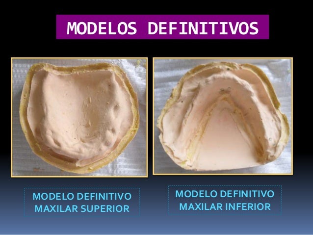 CASO CLÍNICO DE PROTESIS TOTAL