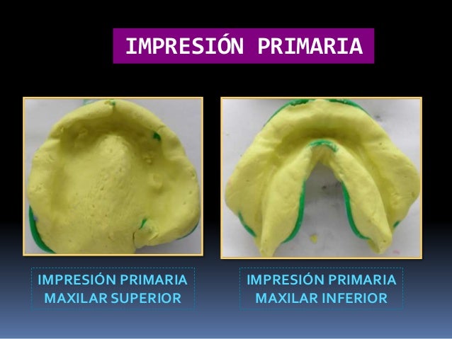 CASO CLÍNICO DE PROTESIS TOTAL