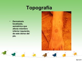 Caso clinico derma | PPT