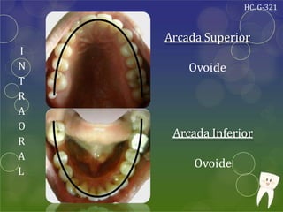 caso clinico exodoncia.pptx