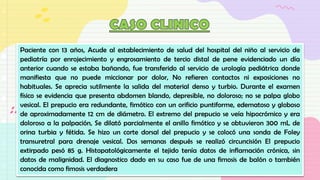 CASO CLINICO FIMOSIS.pptx