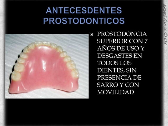 Prostodoncia Total | PPTX