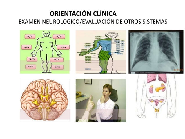 Caso clinico medicina interna criptococosis diseminada | PPT