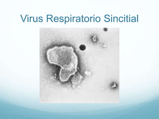 Infección por Virus respiratorio sincitial en adultos | PPTX