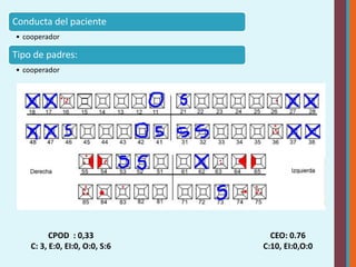 Caso clinico odp | PPTX