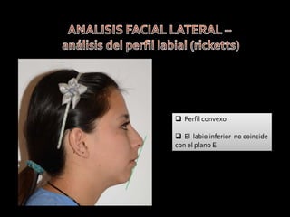 Caso clinico ortodoncia Valeria Fernandez | PPTX
