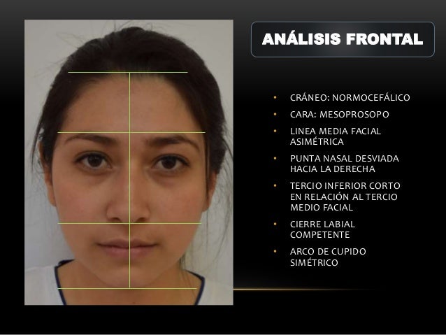 Caso clinico ortodoncia