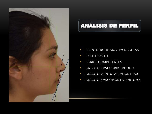 Caso clinico ortodoncia