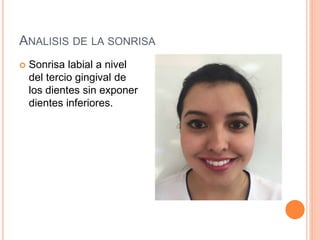 Caso clinico ortodoncia | PPTX