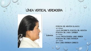 El caso clinico de una paciente mujer en ortodoncia | PPTX