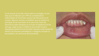 CASO CLINICO Papiloma.pptx