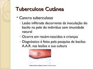 Caso clinico plect | PPT