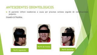 CASO CLINICO PONTICO DE LOS DEINTES ANTERIORES DE UN PACIENTE DE 35 ...