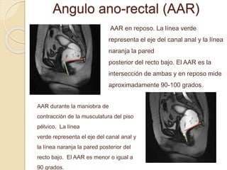 Caso clinico Resonancia magnetica | PPTX